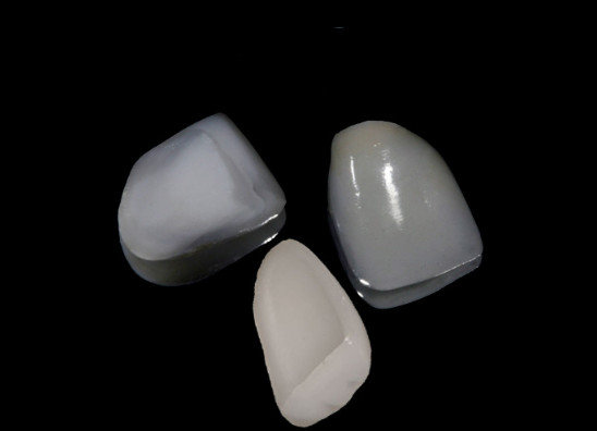 Nature Colored Dental BIOHPP Veneer Teeth Crown For Intra Oral Use ISO9001/2001