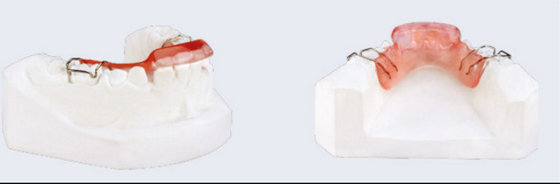Customizable Dental Orthodontic Appliances with Medical Stainless Steel Material