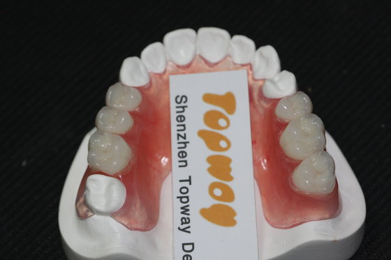Lightweight Dental Valplast Flexible Dentures , Removable Valplast Partial Denture