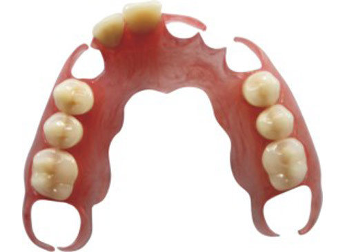 Comfortable Valplast Flexible Dentures Partial For Replace Loss Teeth Non Invasive
