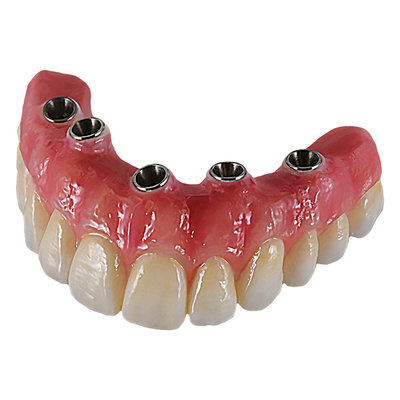 Full Arch Solid Zirconia All On 4 Dentures , All On Four Implant Esthetic Restoration