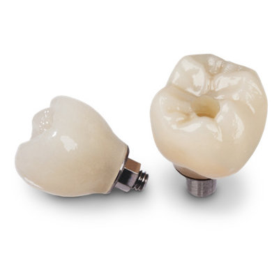 Tooth Clinic Custom Implant Abutment With Titanium / Zirconia Material