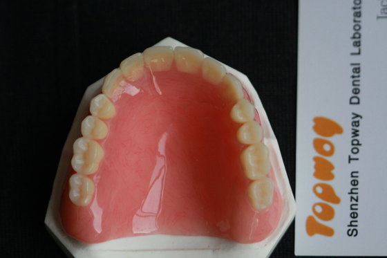 Removable Smooth Acrylic Full Upper Arch Denture For Replace Missing Teeth