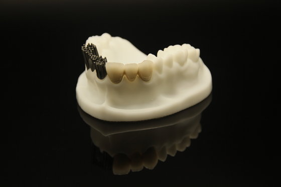 Dental Laser Milled Co-Cr Metal Crowns And Bridge With 3D Printing Technology