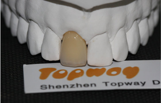 Dental Lab 2 Teeth Zirconia Dental Crown , Tooth Cap For Front Teeth