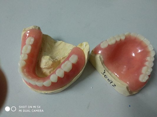 Dental Restoraton Acrylic Removable Partial Denture With Composite Teeth , Easy To Clean