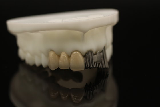 Dental Lab Prints 3D Digital Model Fabricating High - precision Dental Restoration