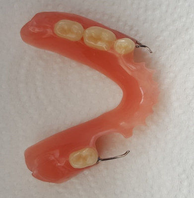 Unbreakable Valplast Flexible Dentures TCS Medical Material With Good Flexibility