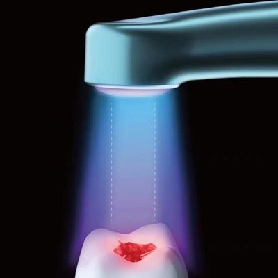 On Sale Dental Led Curing Light Dental Led Light Cure Dental Light Curing Machine With Good Product Quality