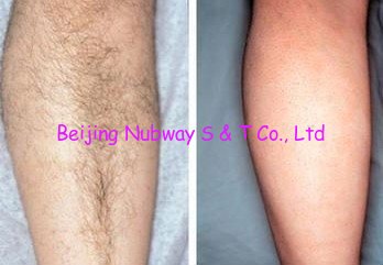 Hot Sales! Shr Super IPL Hair Removal Machine / Quickly Laser Hair Removal Beauty Device