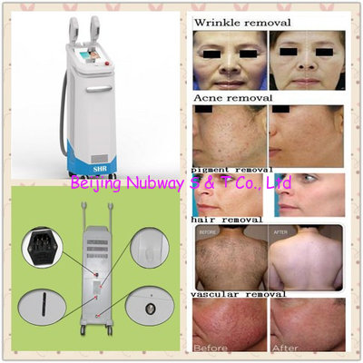 IPL SHR OPT hair removal device/IPL handpiece spare parts shr ipl laser hair removal machine for sale