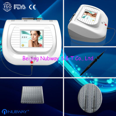 High Frequency Spider Vein Removal Machine, Personal Skin Rejuvenation, Beauty Clinic