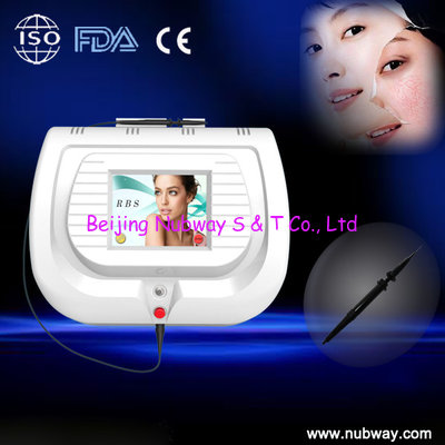 CE Approved 30MHz High Frequency Spider Vein Removal Machine Pigment Removal, Beauty Spa