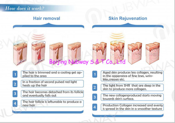 Factory Promotion Multifunction IPL SHR Elight Laser Hair Removal Skin Rejuvenation Machin