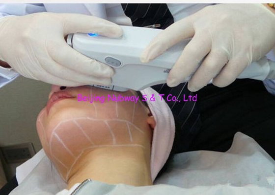 European Best Seller Facial Lifting Ultrasound HIFU Machine for Sale!