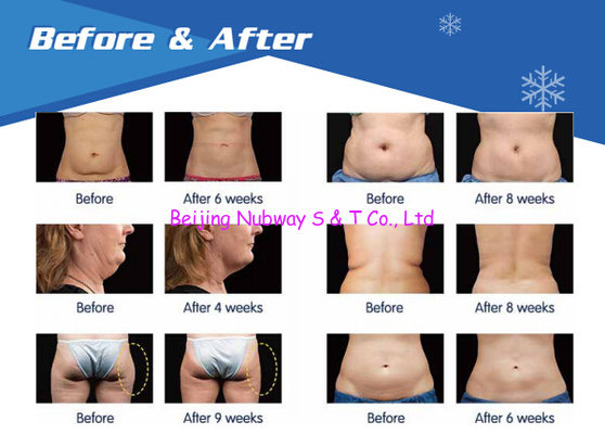 5 Handles Cool Tech Cryolipolysis Cavitation RF Body Slimming Machine / Cryolipo Fat Freezing Machine