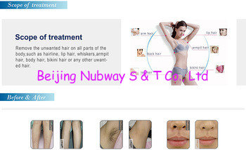 Wholesale soprano 808nm pain free shr diode laser, high quality 808 diode laser, laser diode 808nm for hair removal