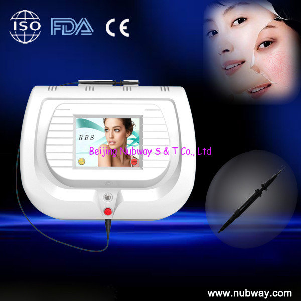 CE Approved 30MHz High Frequency Spider Vein Removal Machine Pigment Removal, Beauty Spa