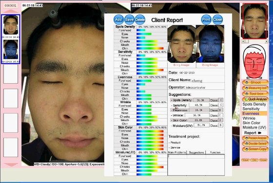 Cosmetic Spa High quality 3d touch screen facial skin analyzer machine