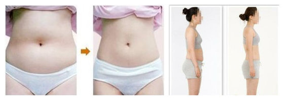 Looking for distributor Portable Ultrasonic RF And Cavitation Slimming Machine 110V/60HZ