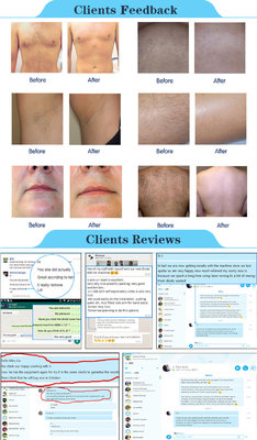 China nubway best popular medical ce approved portable 808 nm diode laser hair removal machine