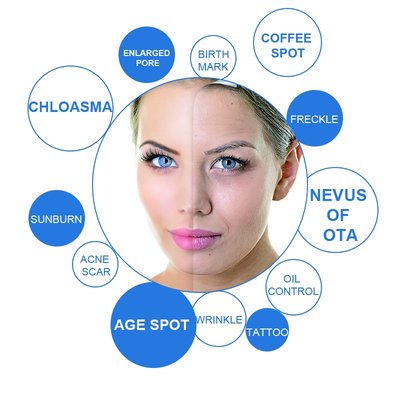 Promotion！laser skin clinic Picosecond Laser Tattoo Removal/Skin Rejuvenation machine NBW-PS II