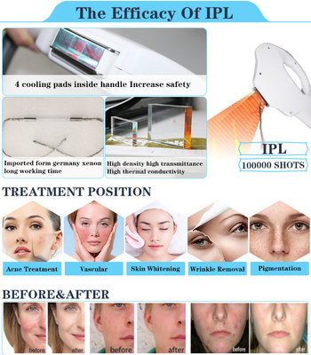 Looking for distributor IPL SHR Hair Removal/Skin Rejuvenation System NBW-SHR212