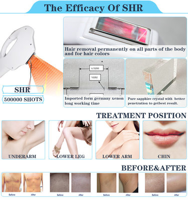 Best Supplier Two Handles IPL SHR Hair Removal/Skin Rejuvenation System NBW-SHR212