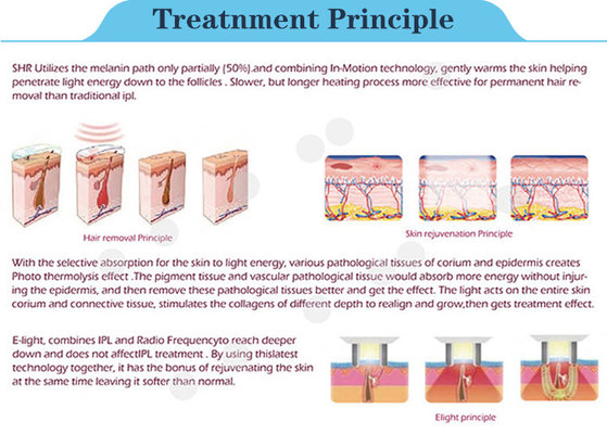 Factory direct sales Wrinkle removal skin care shr ipl beauty equipment