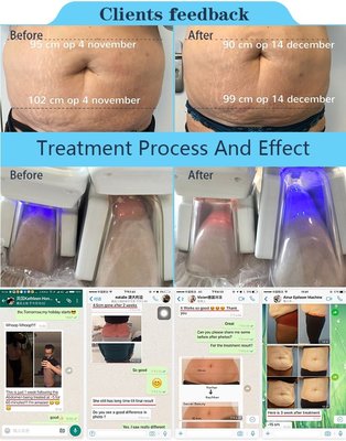 2018 Newly-released!!! The most featured Cryolipolysis Slimming Device four cryo handle can work simulated