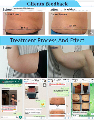 2019 Best Professional Fat Freeze Criolipolisis Machine Cryolipolysis  Multi-Functional beauty equipment Cryolipolyse