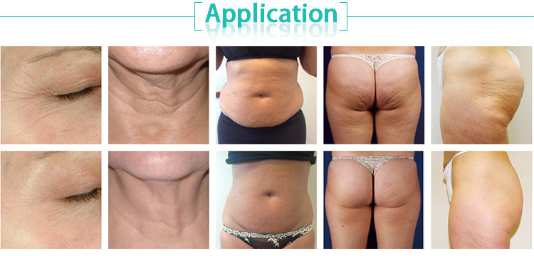 BeautySalon Equipment weight loss machine fat burning instrument vacuum cavitation y radiofrecuencia cavitation home use