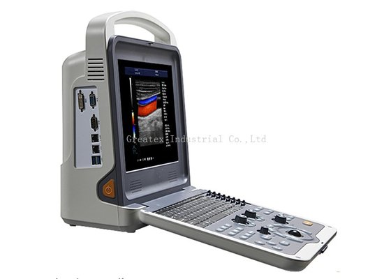 4D Color Electrical Medical Instruments Cardiac Ultrasound System Machine