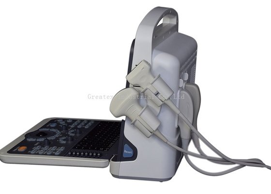 4D Color Electrical Medical Instruments Cardiac Ultrasound System Machine
