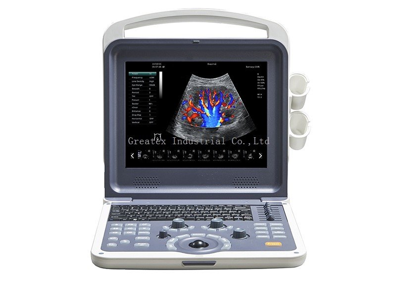 4D Color Electrical Medical Instruments Cardiac Ultrasound System Machine