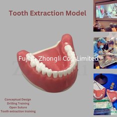 China Good Quality Dental Model Wisdom Teeth Removal supplier