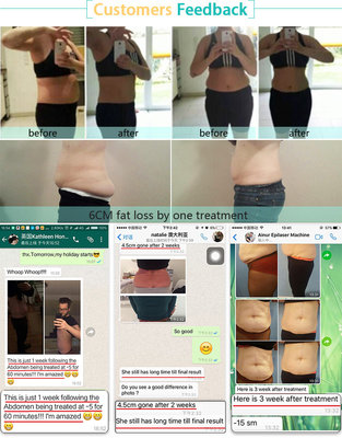 factory best ODM & OEM services big water tank user manual cryolipolysis