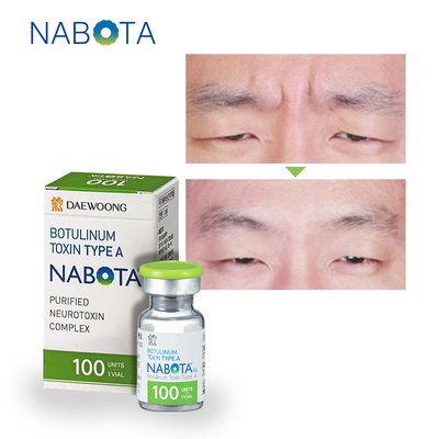 Botulax Botulinum toxin type A From Korea Factory