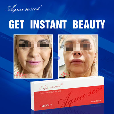 Hyaluronic Acid Dermal Filler 1ml 2ml Lip enhancement Lip Injection