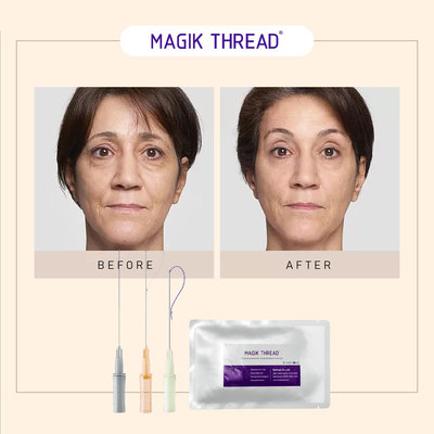 Non Surgical Facial Beauty Korea Face Lifting Cog 4D Pdo Thread