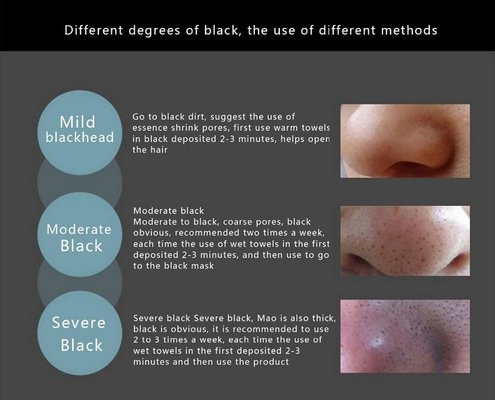 Effective Black Charcoal Pore cleansing and blackhead removal  peel off face mask