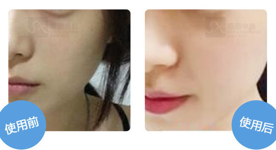 Snake venom peptide Serum for anti-aging