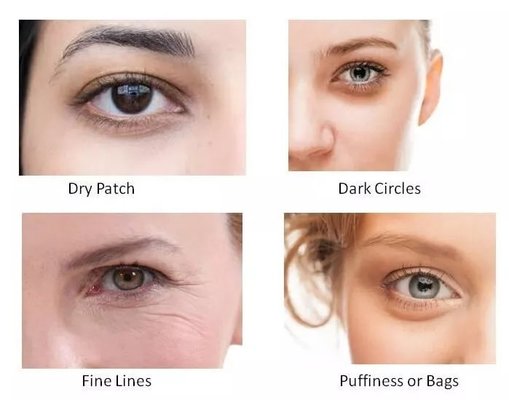 OEM Gold eye patch with Royal jelly extract for anti-wrinkle smoothening fine lines and anti-puffiness