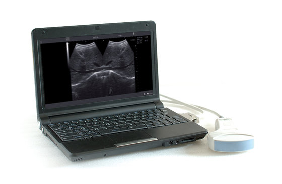 High-Resolution TFT LCD Digital Medical Ultrasound Machine , Laptop Ultrasound Scanner Doppler