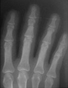 Green Sensitive X Ray Film For Bones And Soft Tissue Examination 25x30cm