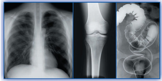 Green / Blue Sensitive CT Mammography Laser X Ray Film Developer And Fixer
