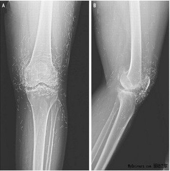 Medical Dry Imaging Film Scan Film , CT Laser Agfa Fuji X-Ray Film