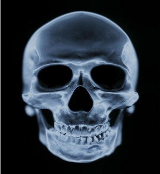 Medical Dry Imaging Film Scan Film , CT Laser Agfa Fuji X-Ray Film