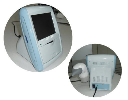Bladder ultrasound machine 3D ultrasound small size portable bladder scanner for Urology
