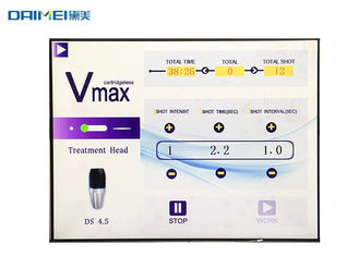 V-MAX High Intensity Focused Ultrasound For Face Lifting 3.0mm 4.5mm 2 Cartridges supplier